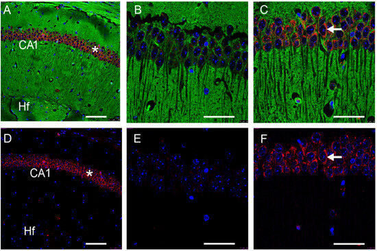 GFRAL Is Widely Distributed in the Brain and Peripheral Tissues of Mice