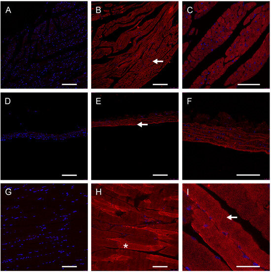 GFRAL Is Widely Distributed in the Brain and Peripheral Tissues of Mice
