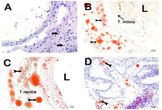 Propolis Reduces Inflammation and Dyslipidemia Caused by High ...
