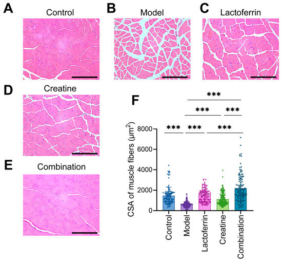 The Combination of Lactoferrin and Creatine Ameliorates Muscle Decay in ...