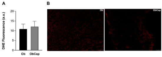 Capsinoids Increase Antioxidative Enzyme Activity and Prevent Obesity ...