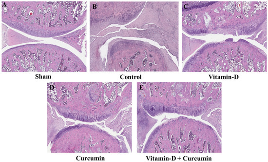 Curcumin and Vitamin D Supplement Attenuates Knee Osteoarthritis ...