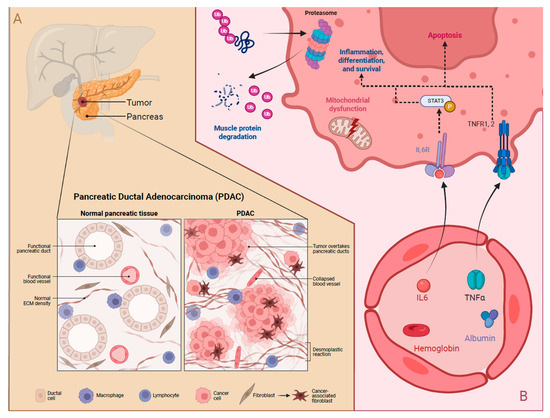 Cachexia in Pancreatic Cancer: New Insights to Impact Quality of Life ...