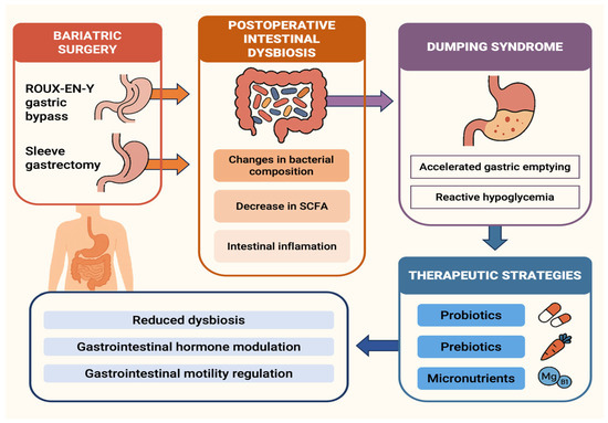 Dumping Syndrome After Bariatric Surgery: Advanced Nutritional ...