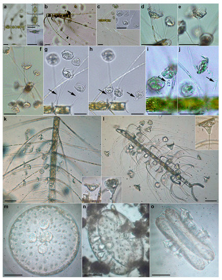Symbioses of Ciliates (Ciliophora) and Diatoms (Bacillariophyceae ...