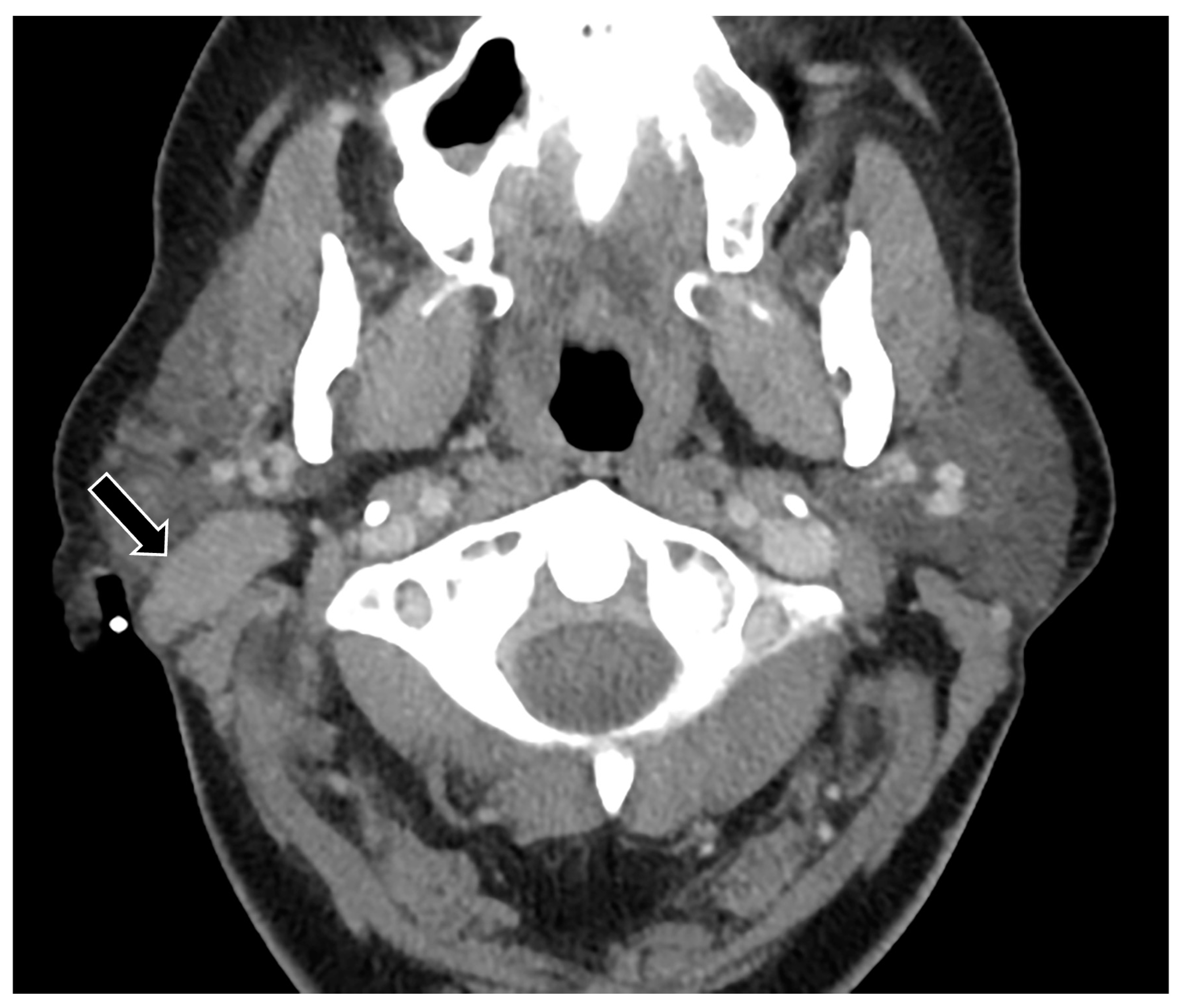 Beyond Ultrasound: Multimodal Cross-Sectional Imaging for Preoperative ...
