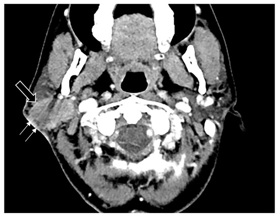 Beyond Ultrasound: Multimodal Cross-Sectional Imaging for Preoperative ...