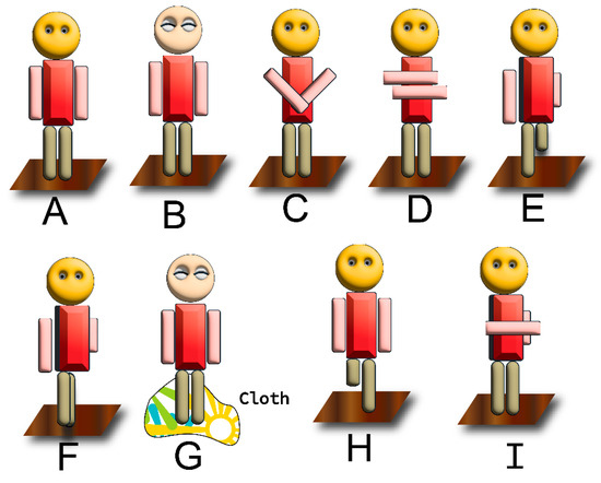 Comparison of Halmágyi–Curthoys Head Impulse (Thrust) Test with Romberg ...