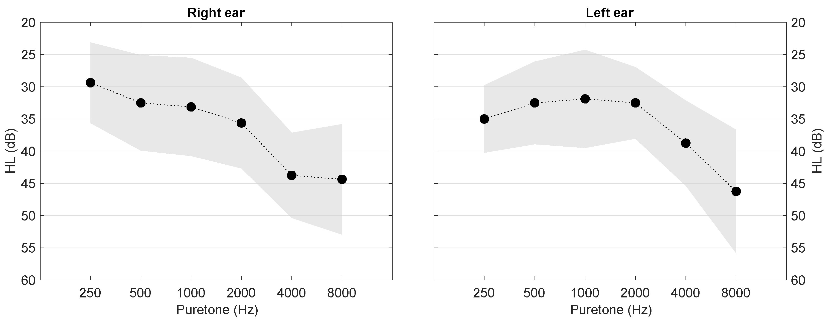 The Intelligibility Benefits of Modern Computer-Synthesized Speech for ...