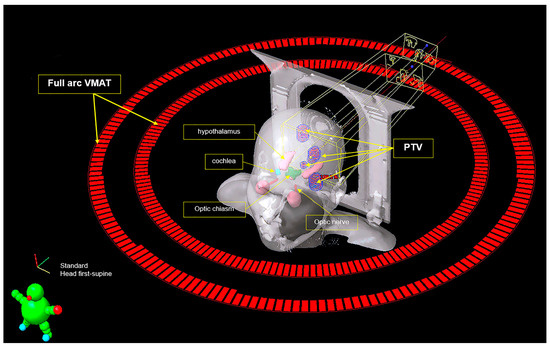 Fractionated Volumetric Modulated Arc Therapy (FVMAT) for ...