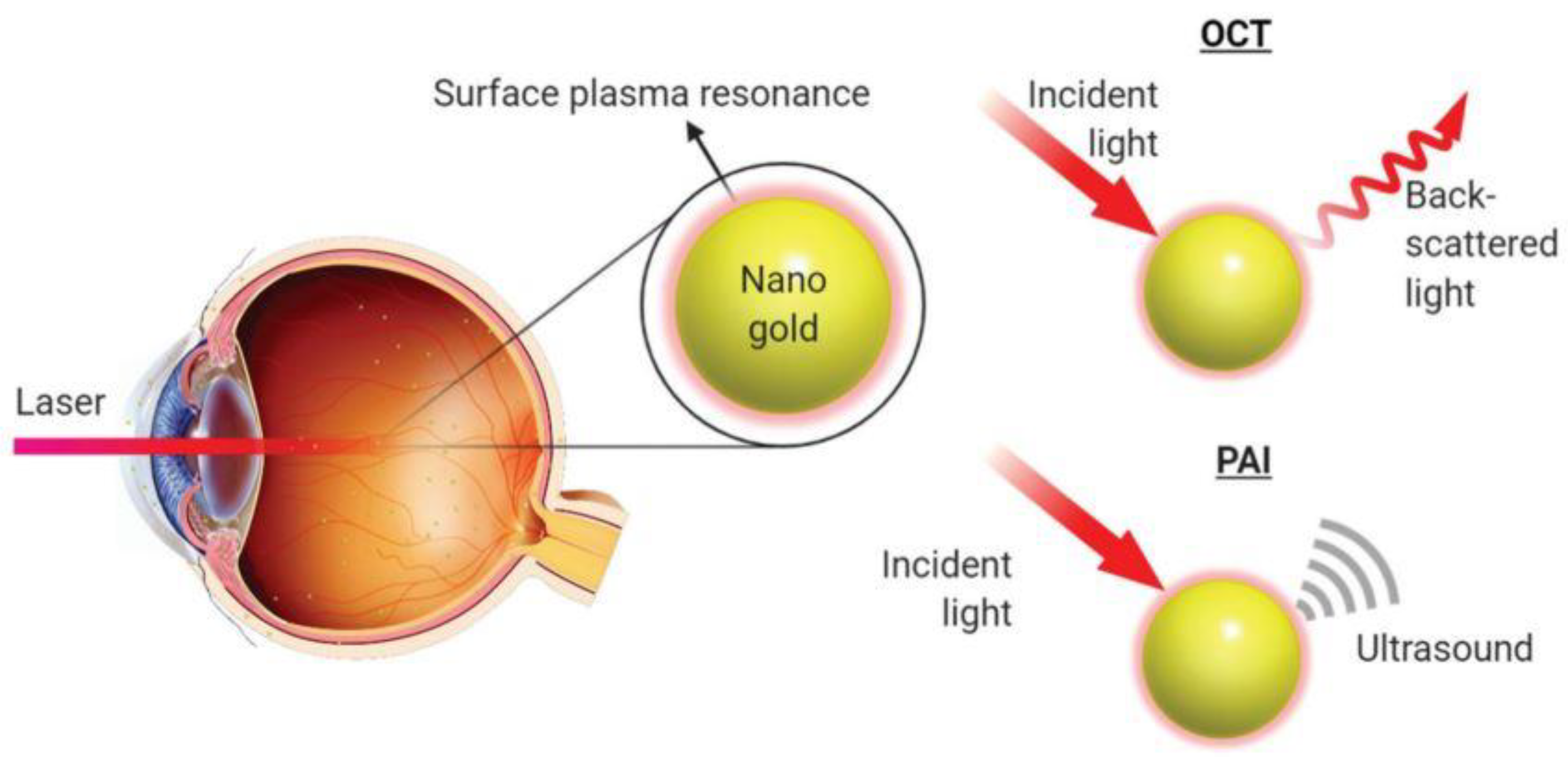 Gold Nanoparticles Imaging at Rachael Sattler blog Gold Nanoparticles Imaging at Rachael Sattler blog