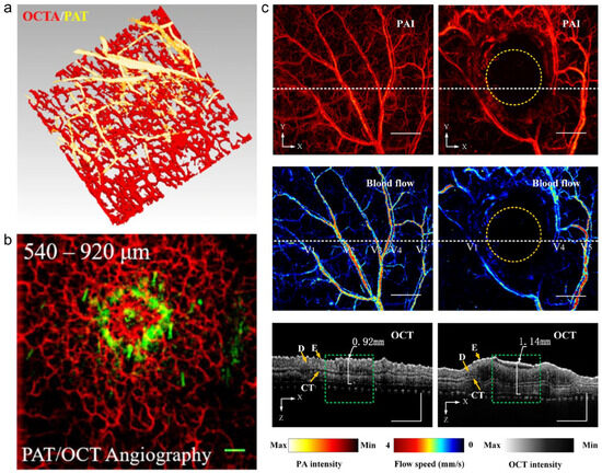 Skin Imaging Using Optical Coherence Tomography and Photoacoustic ...