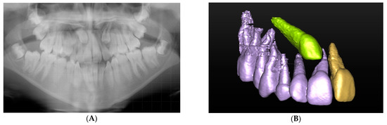 The Use of Cone Beam Computed Tomographic Imaging in a Paediatric ...