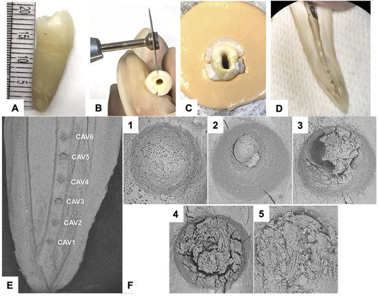 Effectiveness of Passive Ultrasonic Irrigation Protocols in Simulated ...