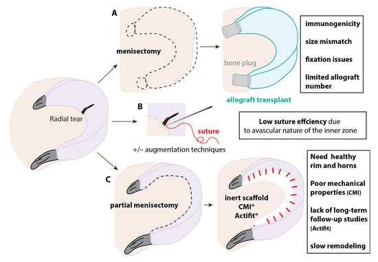 Organoids | Free Full-Text | Meniscus Repair: From In Vitro Research to ...