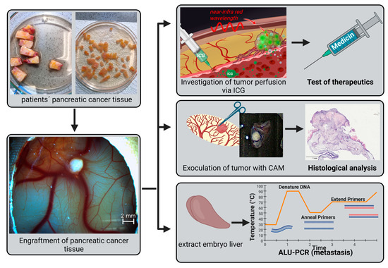 Visualization of Vascular Perfusion of Human Pancreatic Cancer Tissue ...