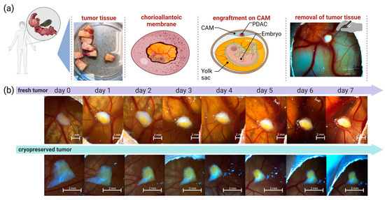 Visualization of Vascular Perfusion of Human Pancreatic Cancer Tissue ...