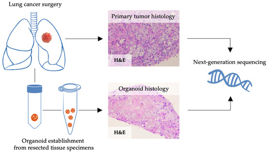 Establishment and Validation of Patient-Derived Non-Small Cell Lung ...