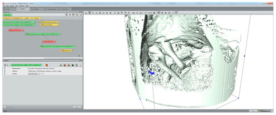 Human Middle Ear Anatomy Based on Micro-Computed Tomography and ...