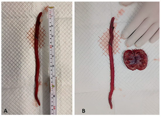 Dioctophyme renale in a 5-Month-Old Puppy from Delta del Tigre, Uruguay