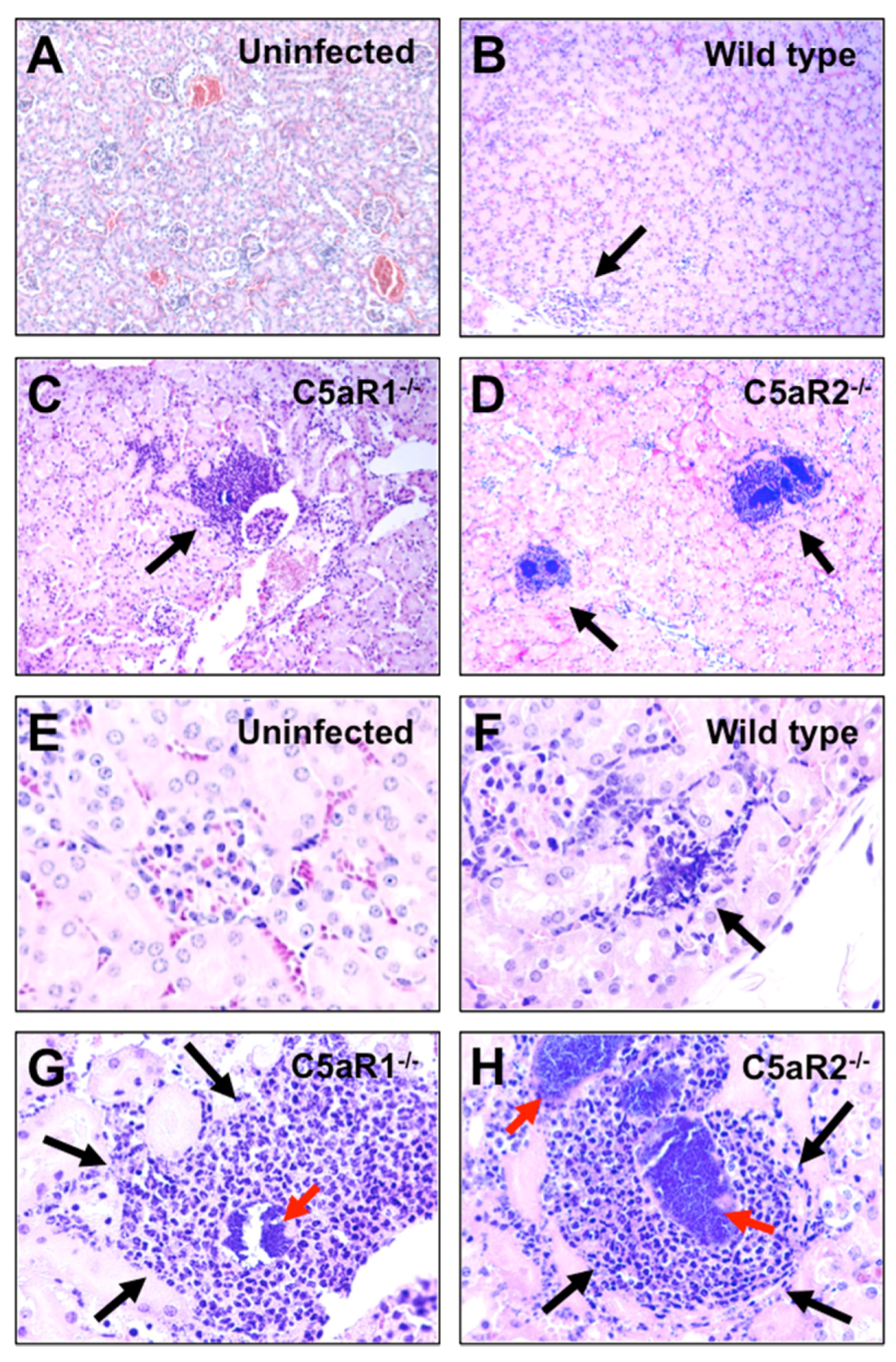 Pathogens | Special Issue : Staphylococcus Aureus Infection