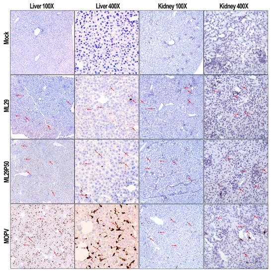 Pathogens | Special Issue : Lassa Fever: Viral Replication, Disease ...