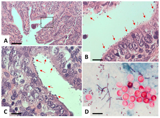 Comparative Pathobiology of the Intestinal Protozoan Parasites Giardia ...