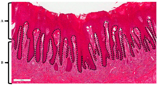 Immunohistochemical Expression Patterns of Inflammatory Cells Involved ...