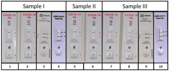 Limits and Opportunities of SARS-CoV-2 Antigen Rapid Tests: An ...