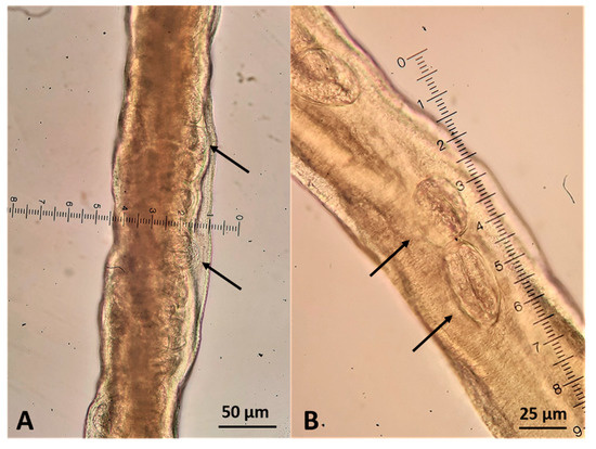 An Unusual Case of Mixed Respiratory Capillariosis in a Dog
