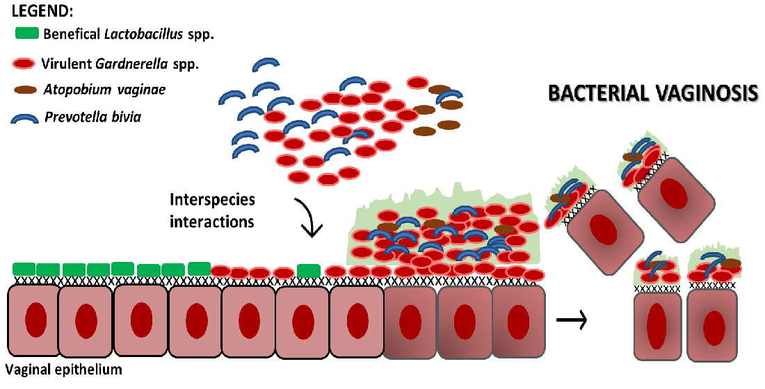 Pathogens | Free Full-Text | Atopobium vaginae and Prevotella bivia Are ...