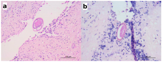Pathology of Urinary Bladder in Pearsonema spp. Infected Wildlife from ...