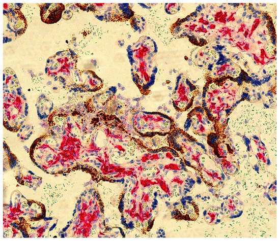 Pathogens | Free Full-Text | Molecular Pathology Analysis of SARS-CoV-2 ...