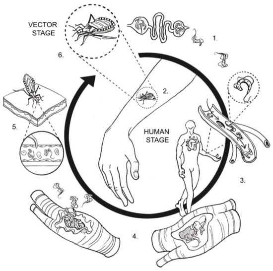 Chagas Cardiomyopathy: From Romaña Sign to Heart Failure and Sudden ...