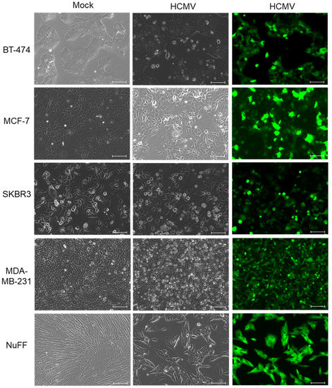 Productive Infection of Human Breast Cancer Cell Lines with Human ...