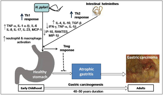 Helicobacter pylori-Induced Inflammation: Possible Factors Modulating ...