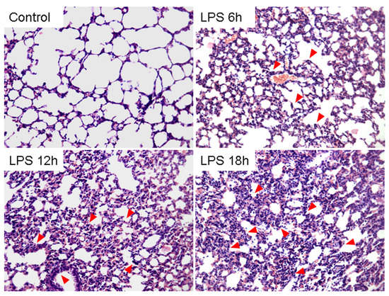 Microarray Profiling and Co-Expression Network Analysis of LncRNAs and ...