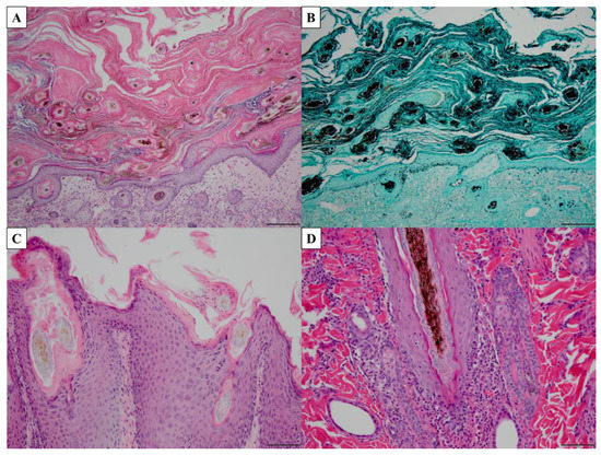 Current Topics in Dermatophyte Classification and Clinical Diagnosis