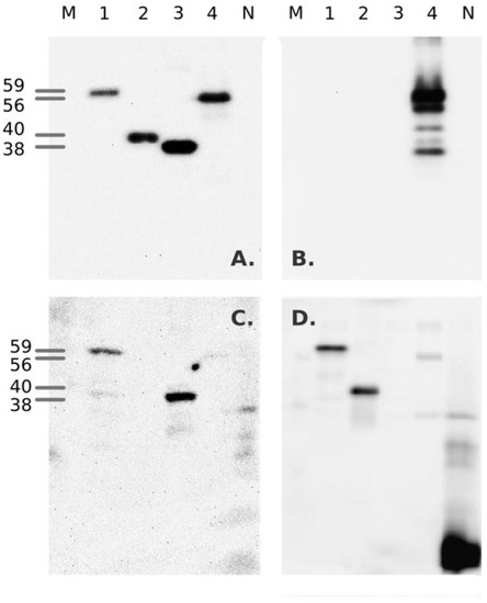 Tetraplex Fluorescent Microbead-Based Immunoassay for the Serodiagnosis ...