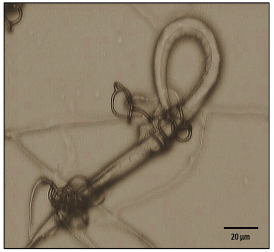 Arthrobotrys musiformis (Orbiliales) Kills Haemonchus contortus ...