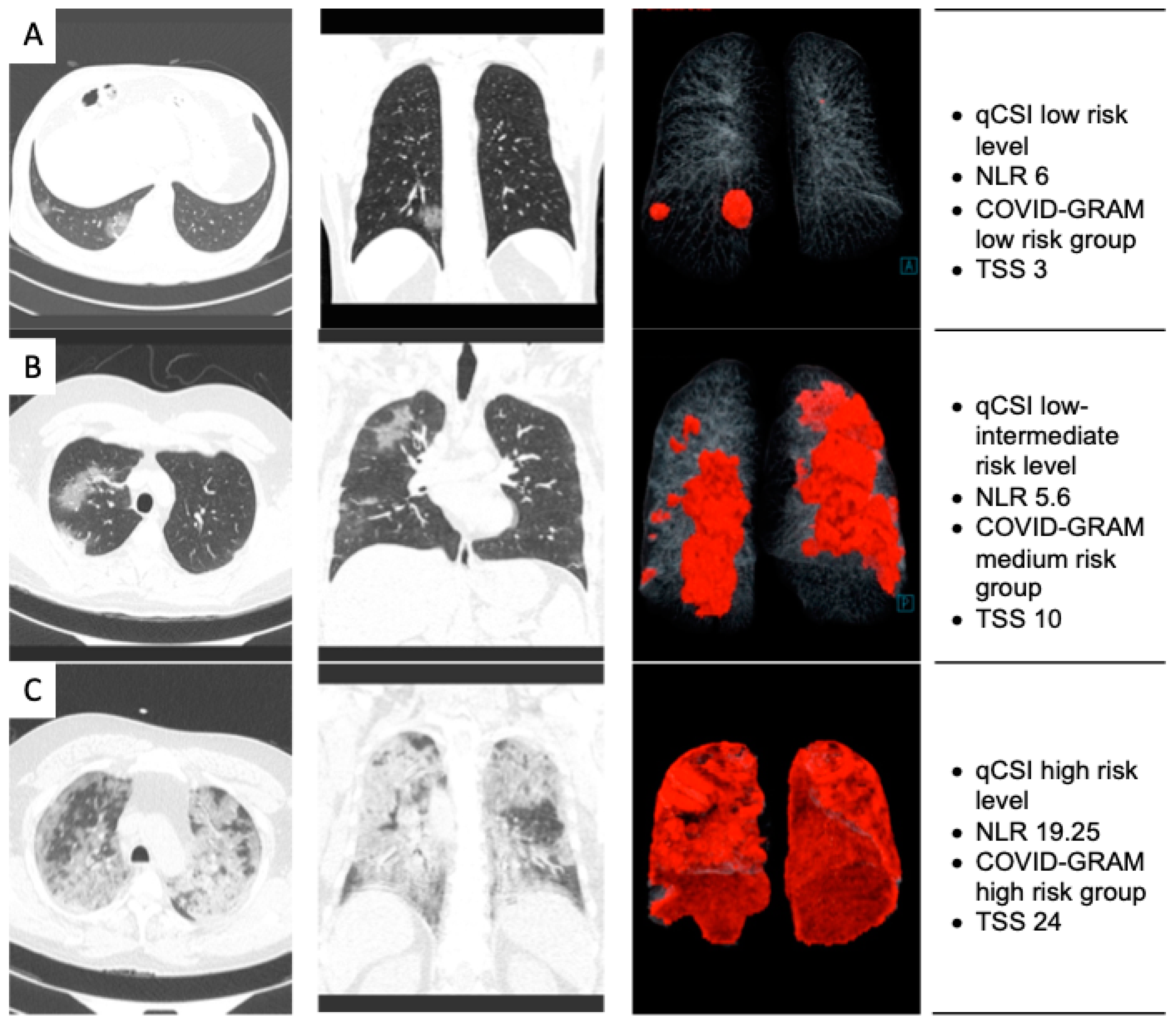 Pathogens | Free Full-Text | Tomography and Prognostic Indices in the State of the Art of ...