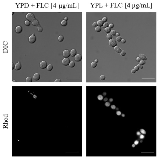 The Role of ERG11 Point Mutations in the Resistance of Candida albicans to Fluconazole in the ...