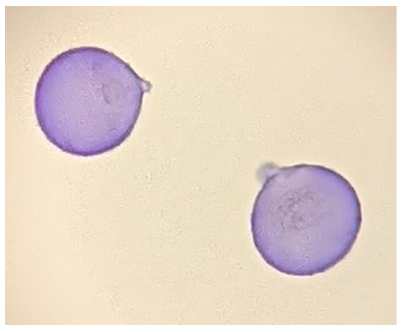 Sublingual Immunotherapy for Japanese Cedar Pollinosis: Current ...