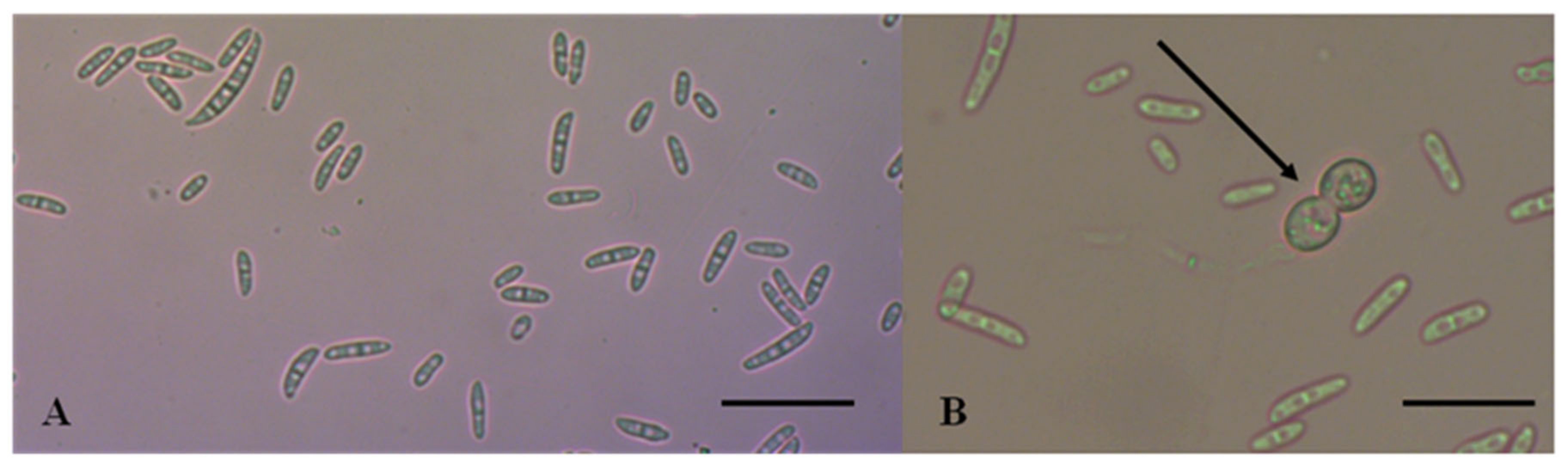 Fusarium equiseti as an Emerging Foliar Pathogen of Lettuce in Greece ...