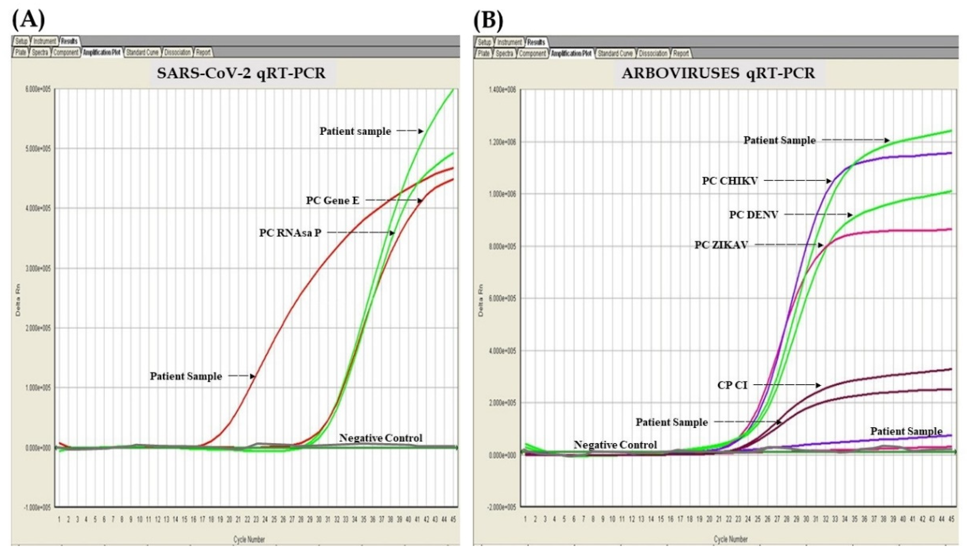SARS-CoV-2 and Dengue Virus Coinfection in a Mexican Pediatric Patient: A Case Report from Early ...