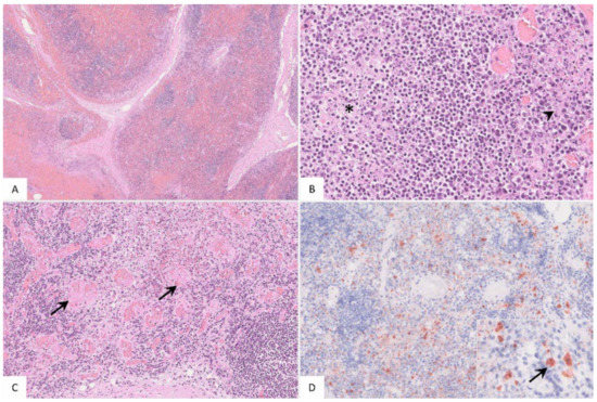 Pathology of African Swine Fever in Wild Boar Carcasses Naturally ...