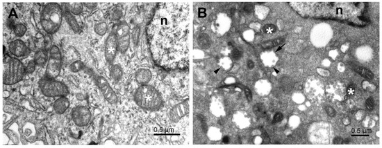 SARS-CoV-2 Exploits Non-Canonical Autophagic Processes to Replicate, Mature, and Egress the ...