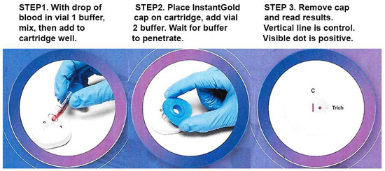 Point-of-Care Diagnostic for Trichomonas vaginalis, the Most Prevalent ...