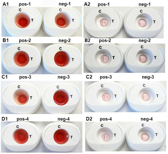 Point-of-Care Diagnostic for Trichomonas vaginalis, the Most Prevalent ...