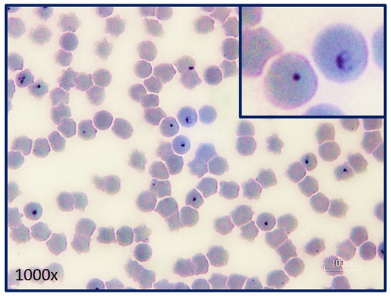 Cytauxzoon felis: An Overview